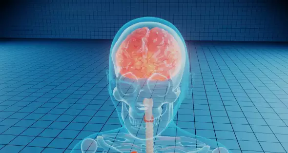 فوتیج آناتومی بدن انسان: مغز 28892 3D Render Animation Of Brain Damage ...